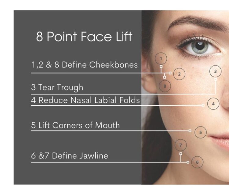 Dermal Fillers – My Laser Clinic